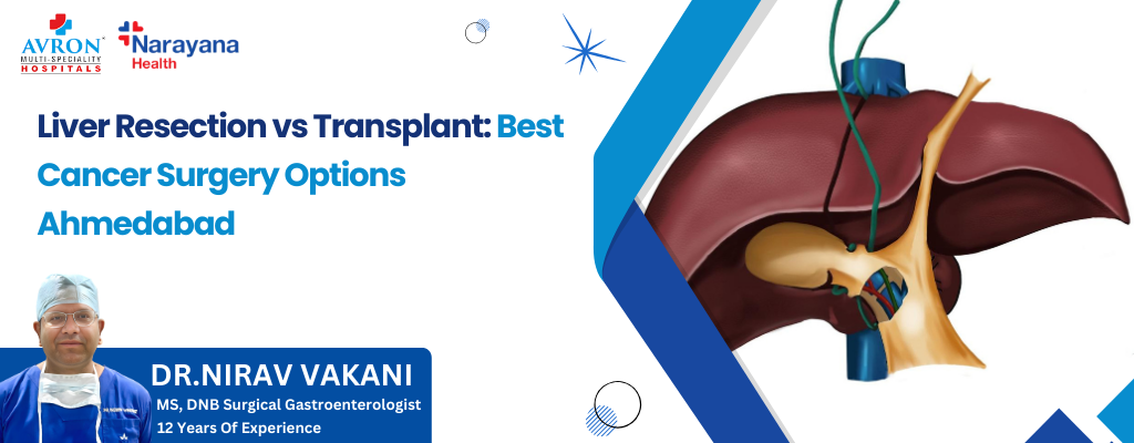 Liver Resection vs Transplant: Cancer Surgery Options Ahmedabad